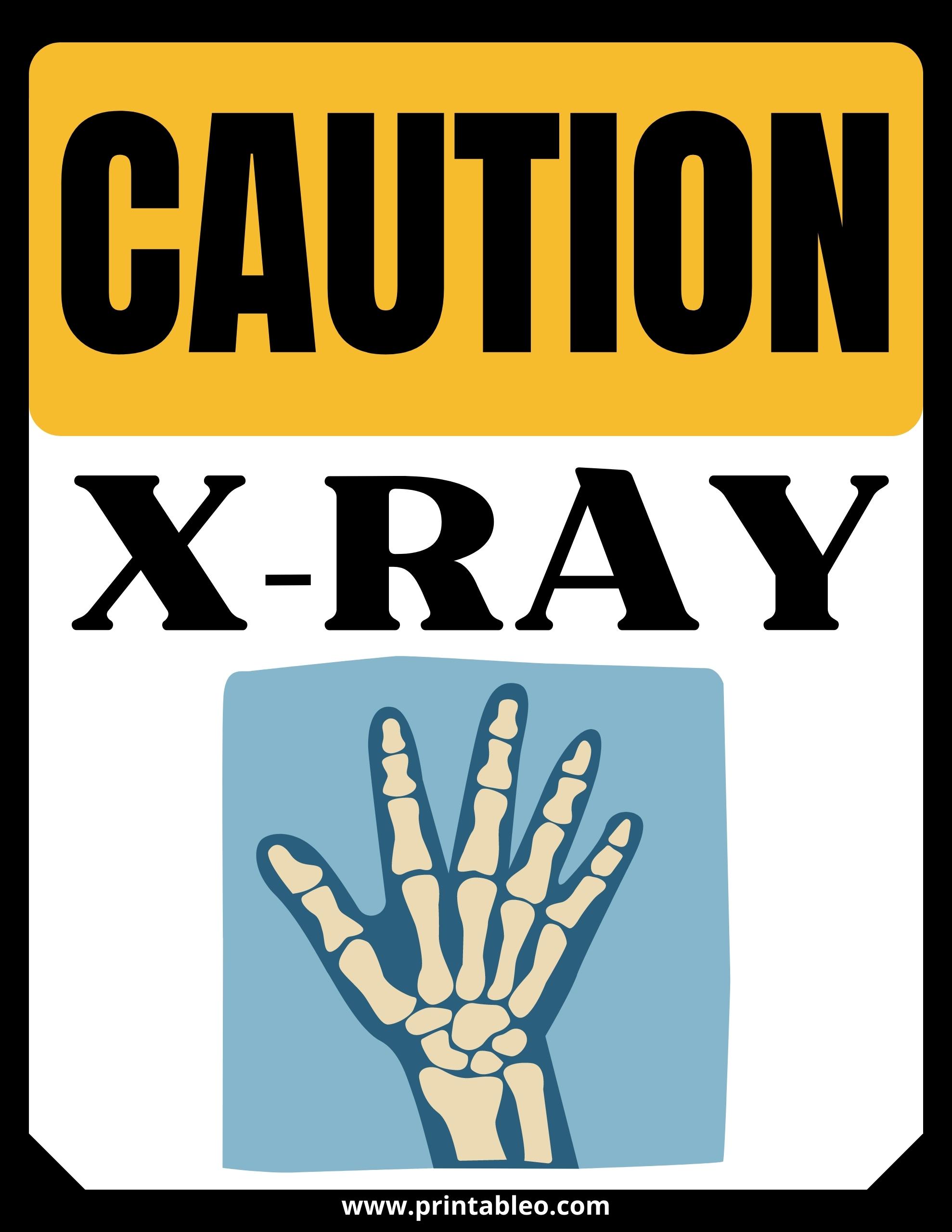 33+ Printable X-Ray Sign | FREE PDF - Printableo.Com